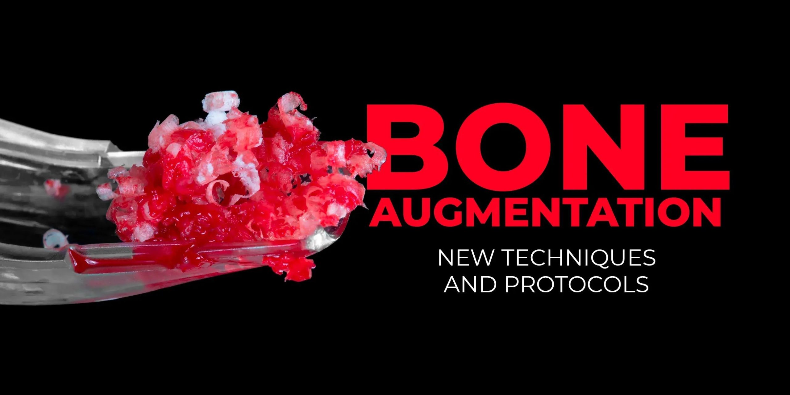 OHI-S Bone Augmentation 2.0, New Techniques and Protocols - Course Medical Shop